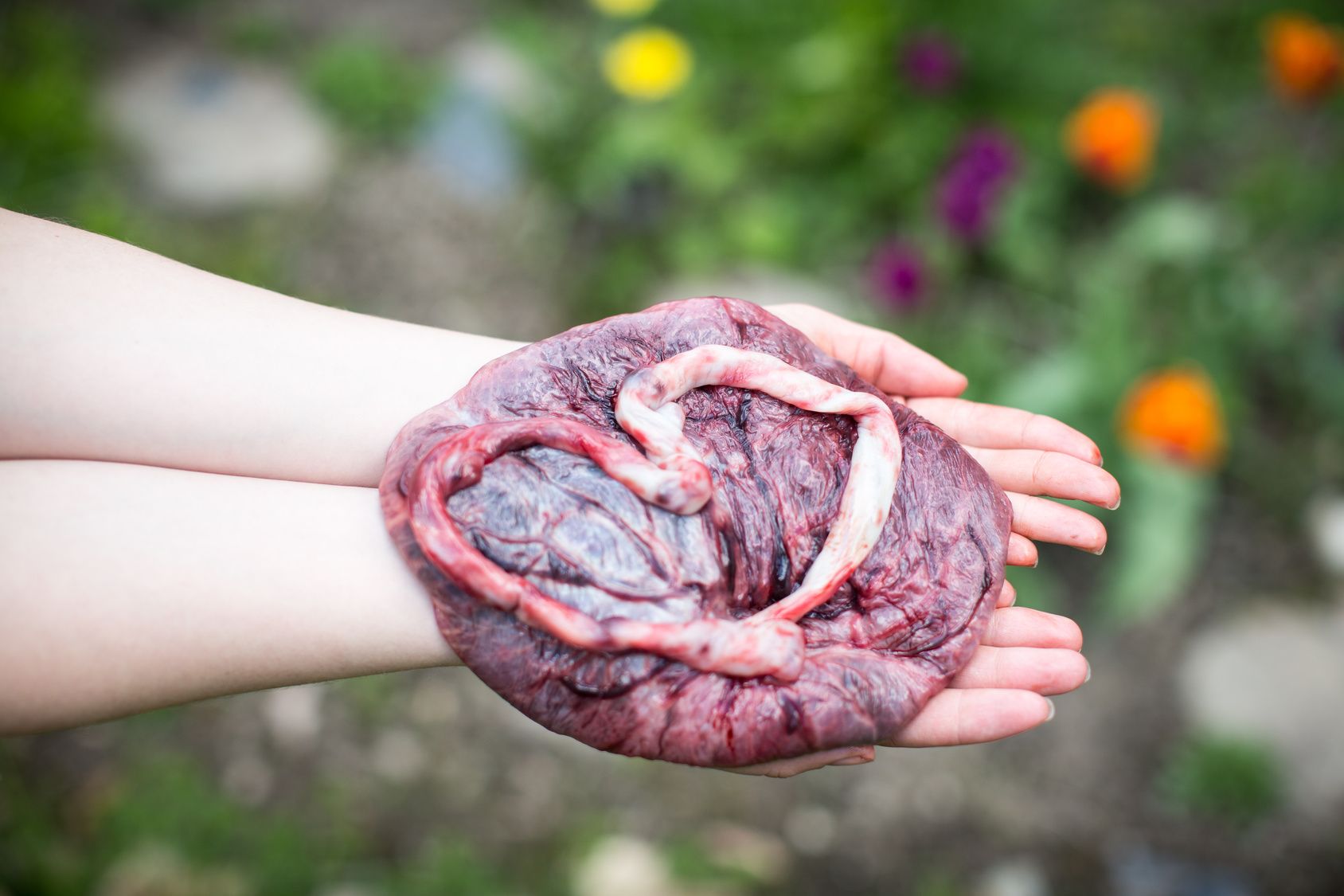 Plazenta essen: So gefährlich ist der Trend wirklich | Babyartikel.de ...